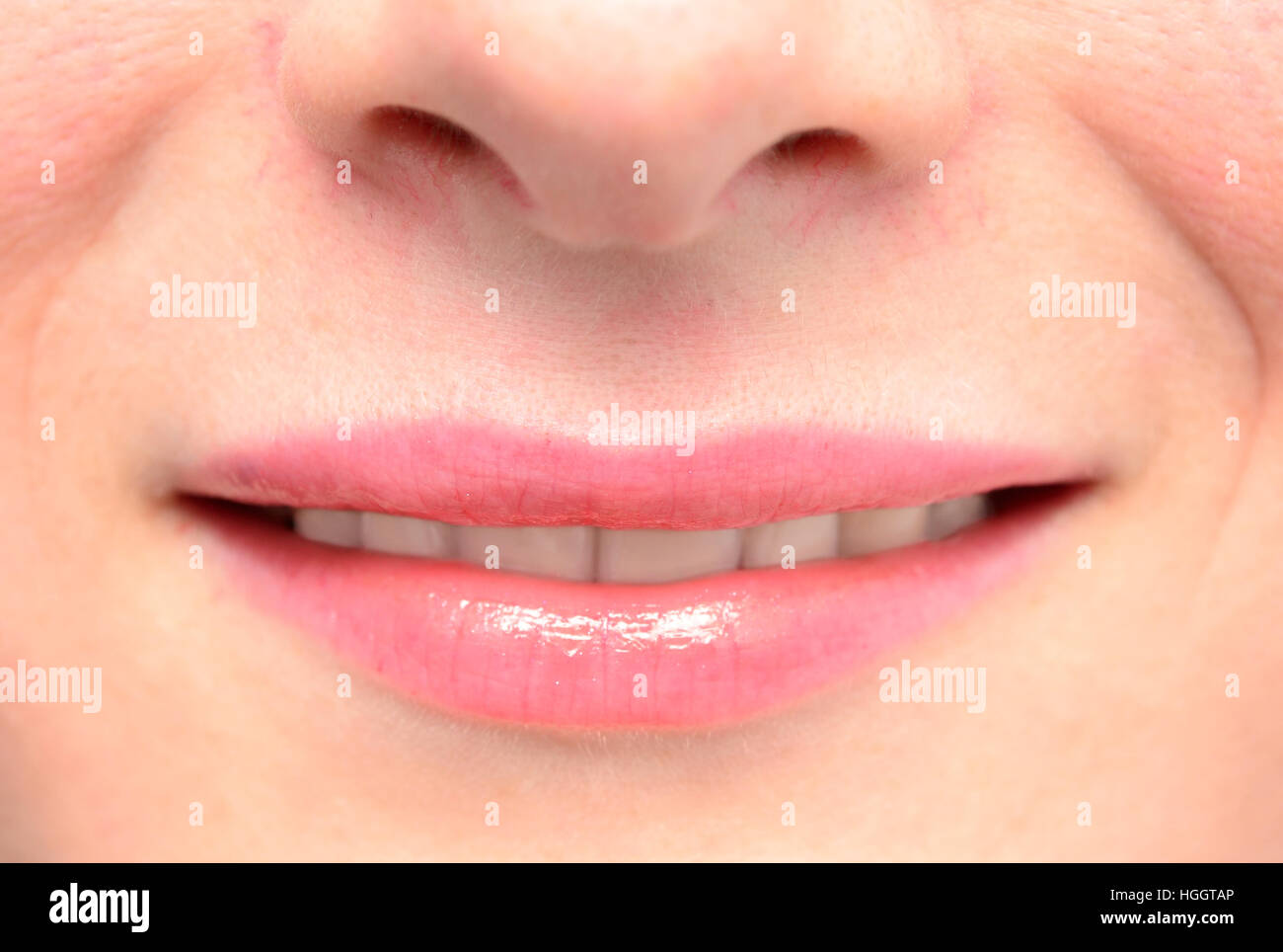 Rotten teeth woman hi-res stock photography and images - Alamy
