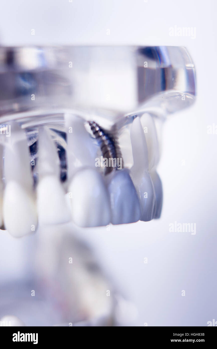 Dentists tooth plastic model used for teaching, learning and patient ...