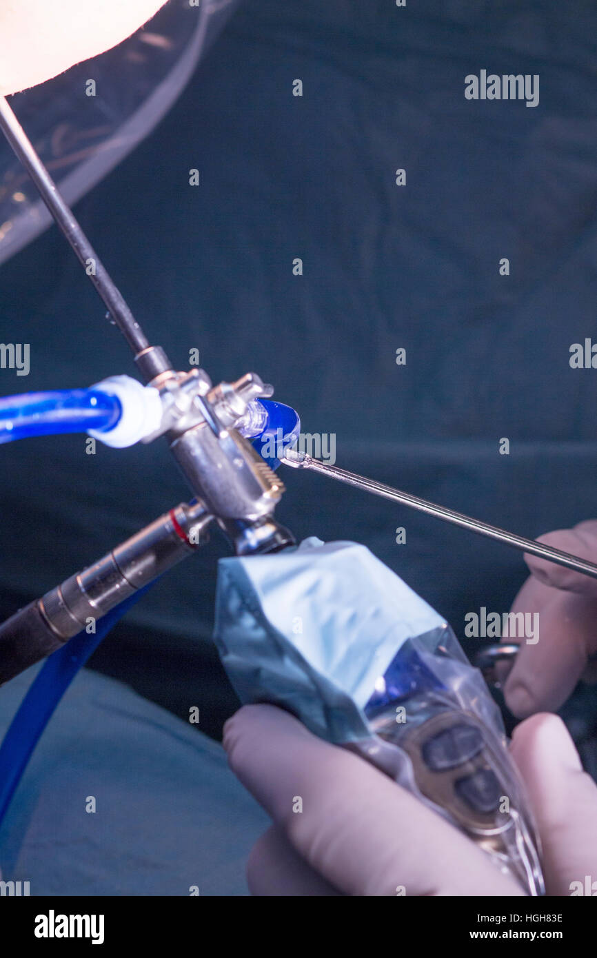 Surgical operation for knee arthroscopy micro surgery in hospital ...