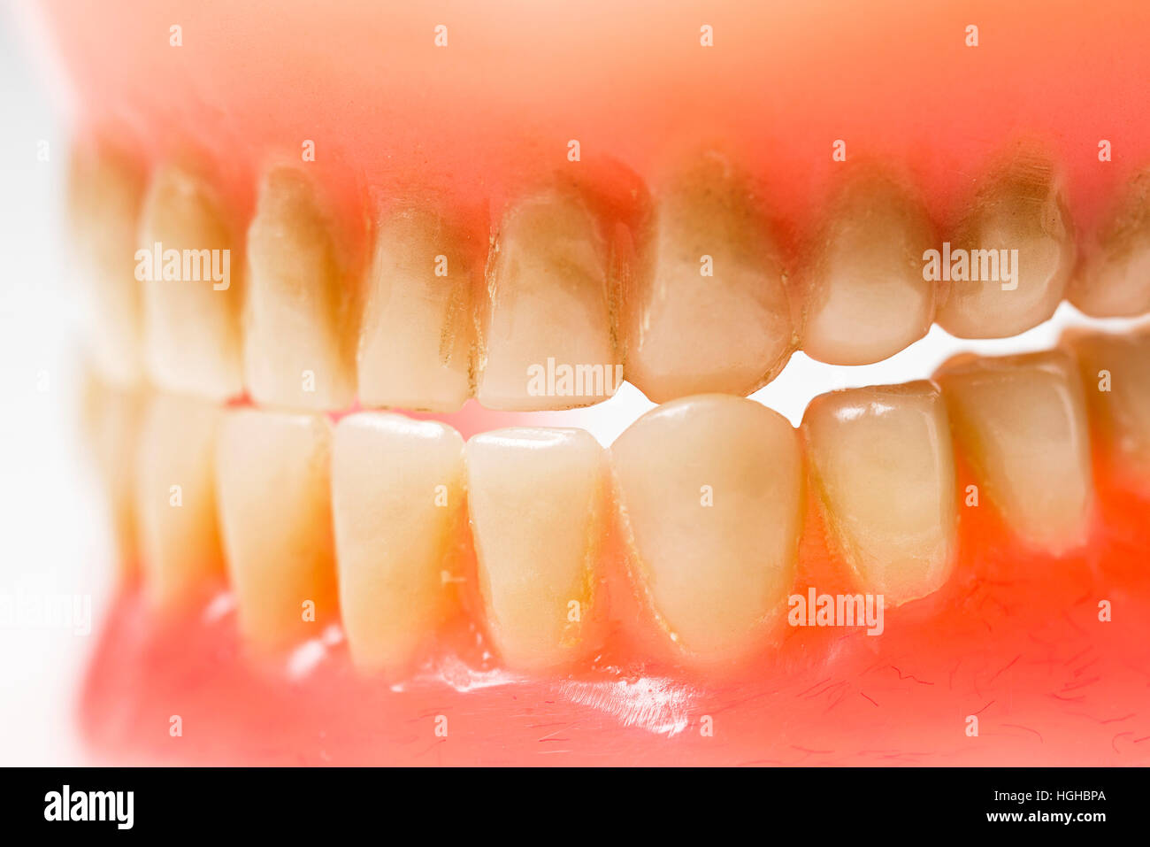dirty dental plate Stock Photo - Alamy