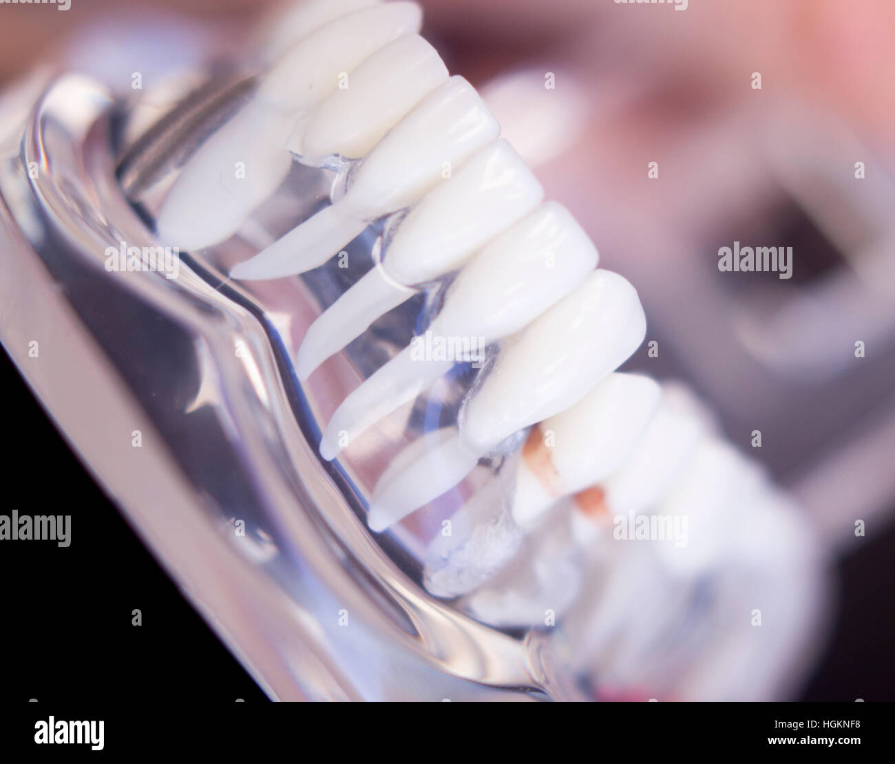 Dentists tooth plastic model used for teaching, learning and patient ...