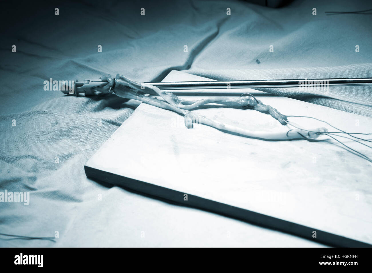 Knee tendon and ligament repair surgery in hospital operating theater ...