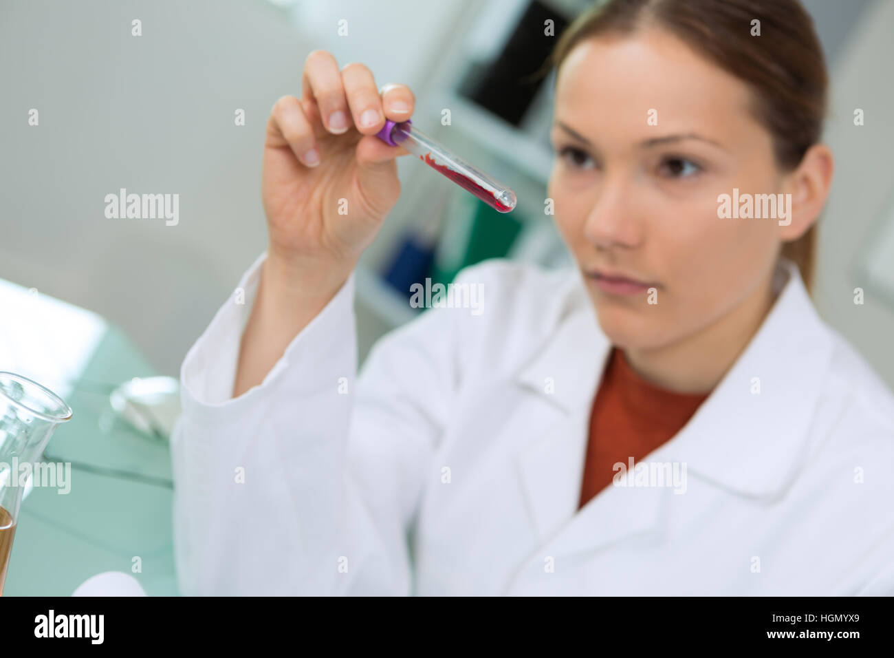 Blood culture instrument hi-res stock photography and images - Alamy