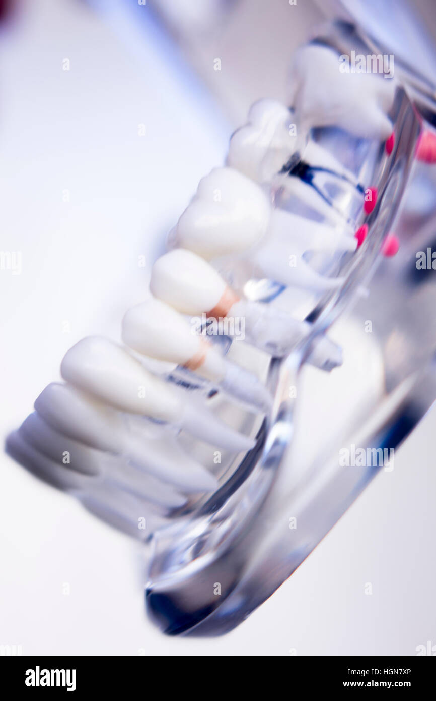 Dentists tooth plastic model used for teaching, learning and patient ...