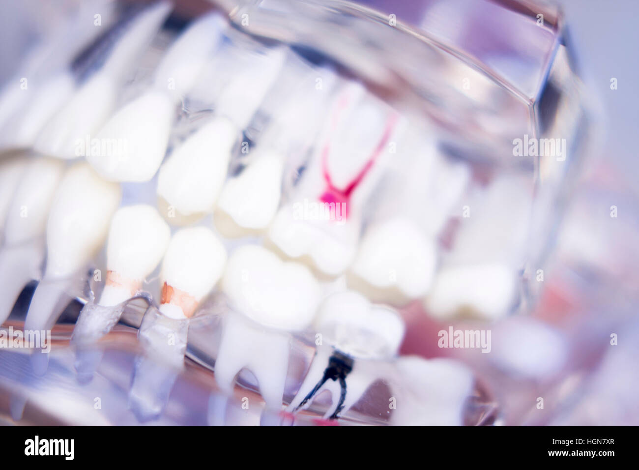 Dentists tooth plastic model used for teaching hi-res stock photography ...