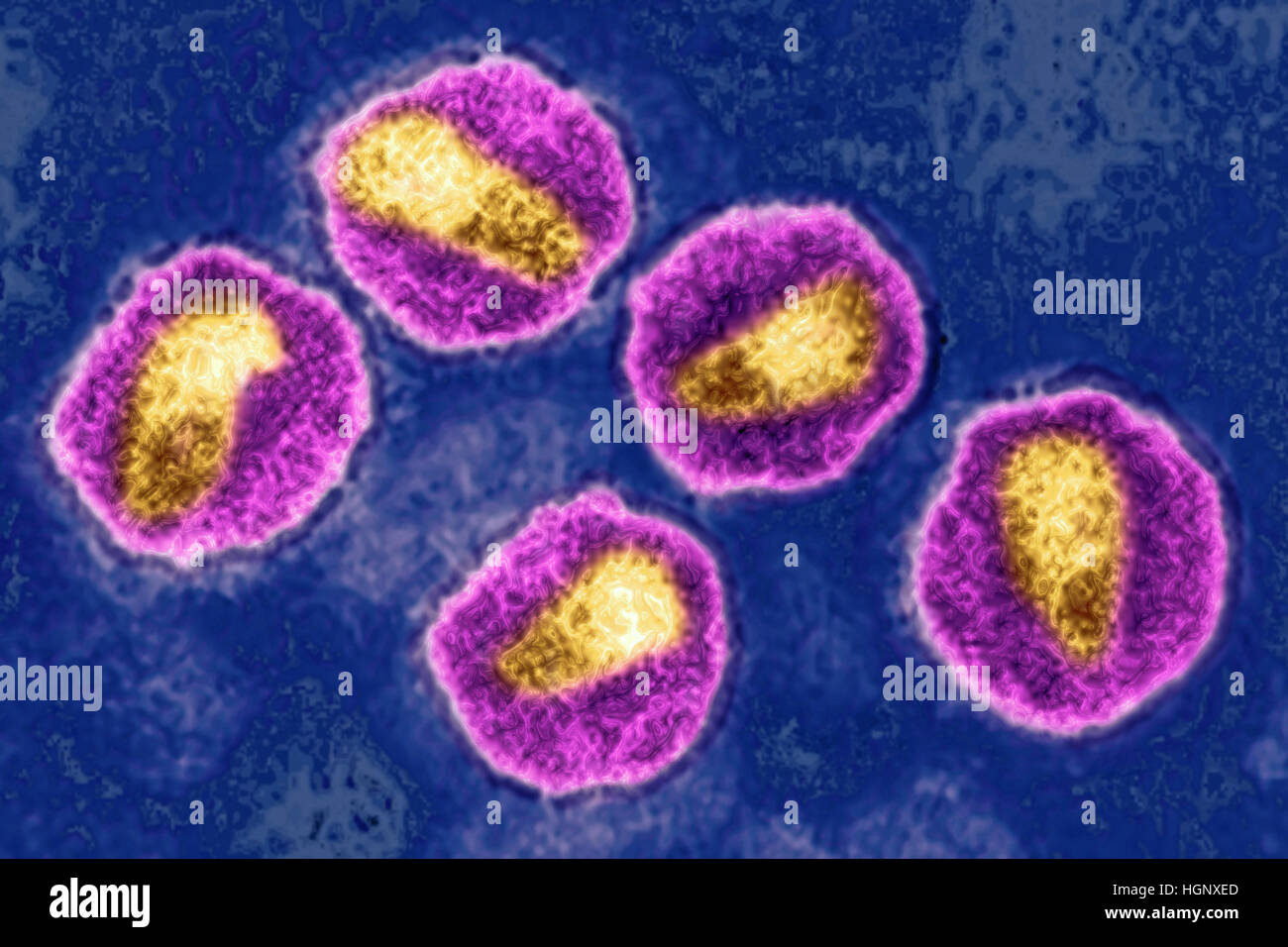 AIDS VIRUS, TEM Stock Photo - Alamy