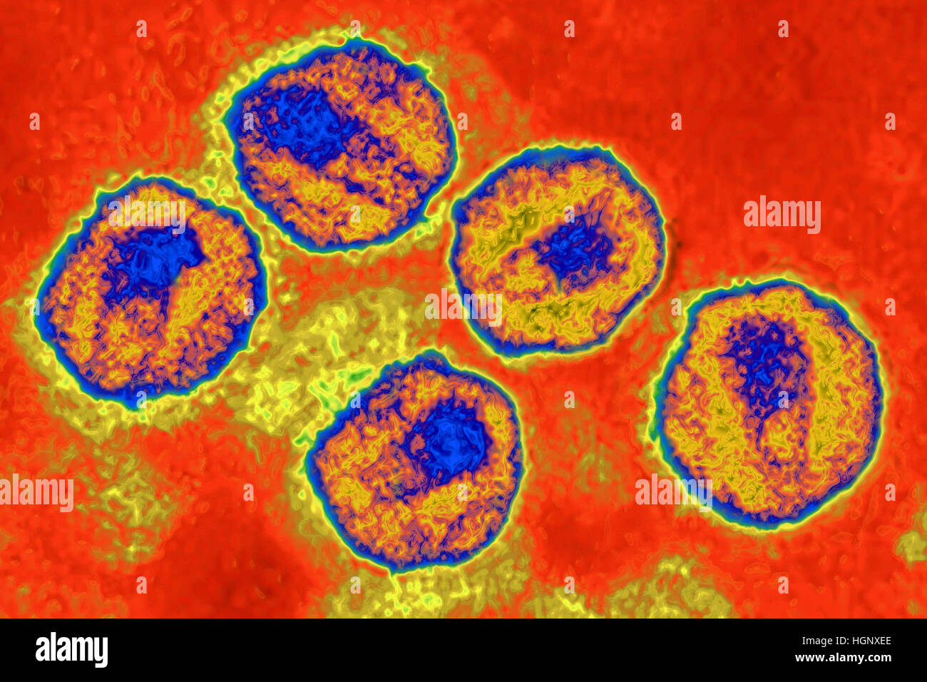 AIDS VIRUS, TEM Stock Photo - Alamy