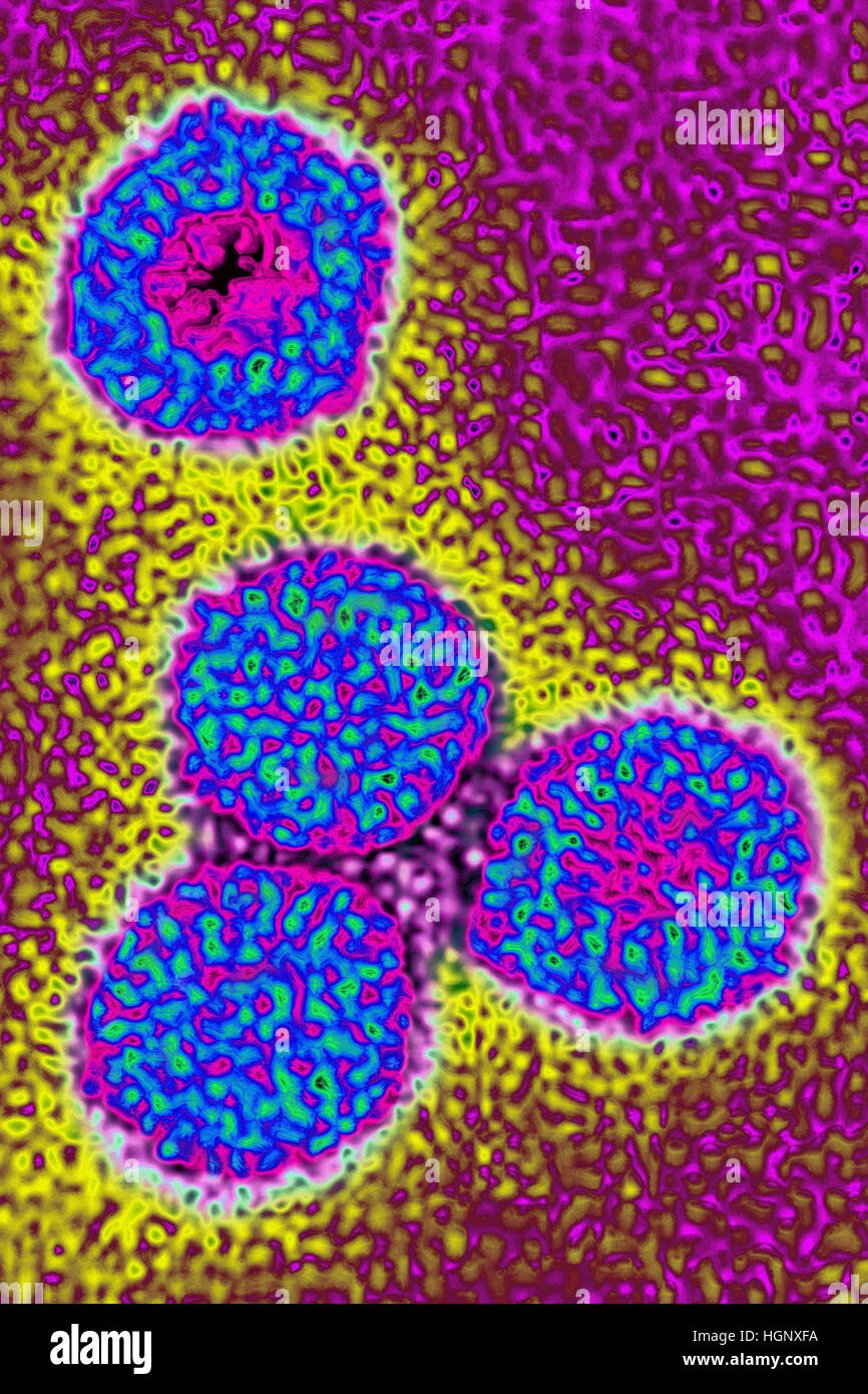 Rotavirus Infection High Resolution Stock Photography and Images - Alamy