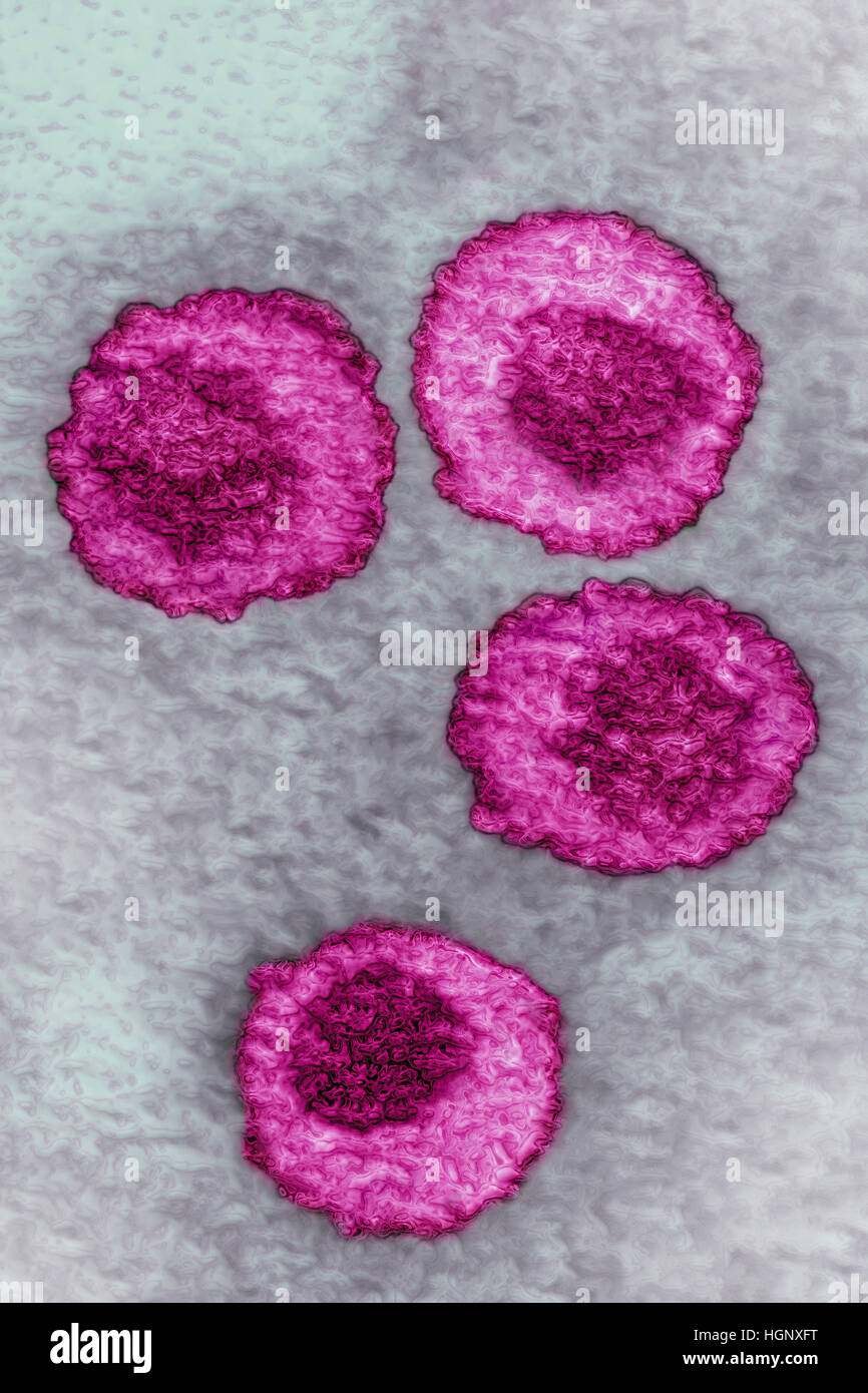 Varicella zoster virus hi-res stock photography and images - Alamy