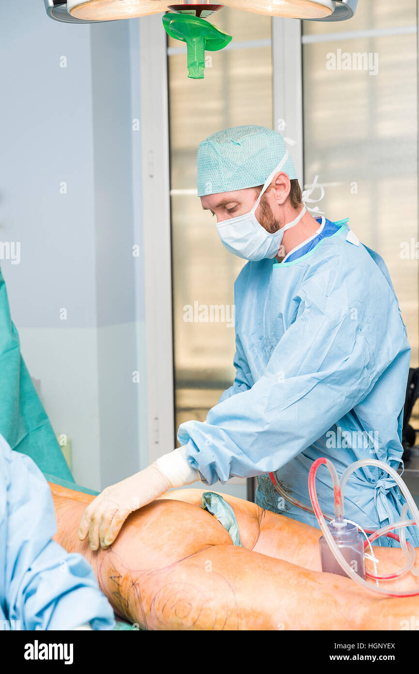 Lipofilling hi-res stock photography and images - Alamy