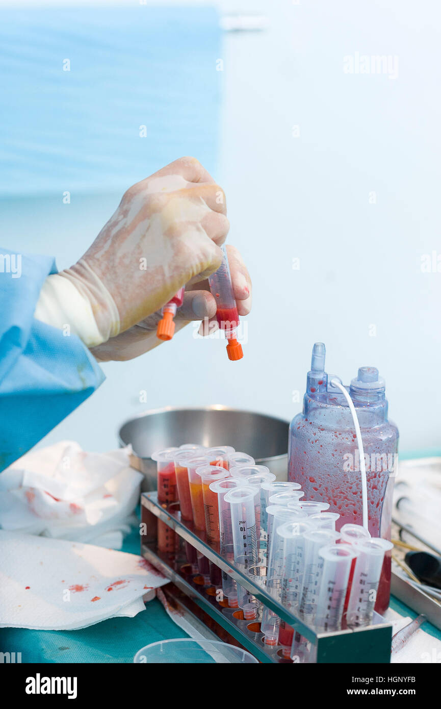 Lipofilling hi-res stock photography and images - Alamy