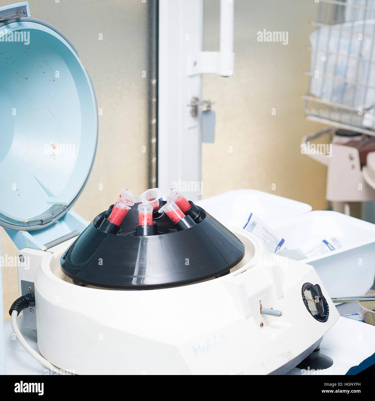 Lipofilling High Resolution Stock Photography and Images - Alamy