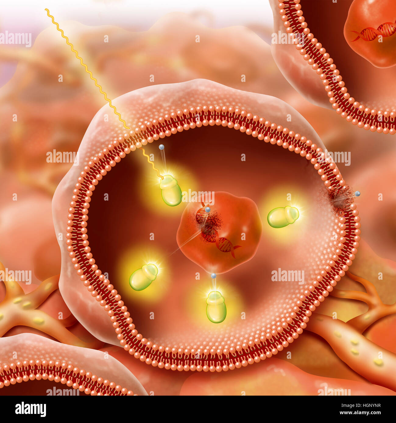 Gamma radiation therapy hi-res stock photography and images - Alamy