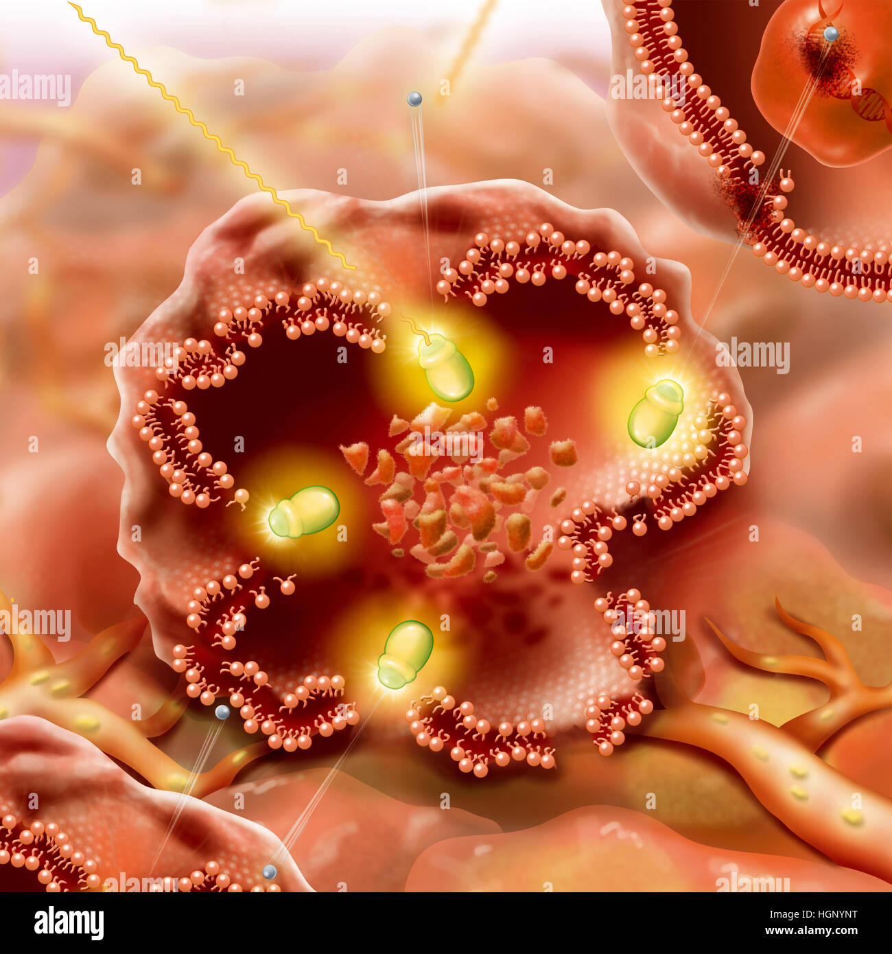 Gamma radiation therapy hi-res stock photography and images - Alamy