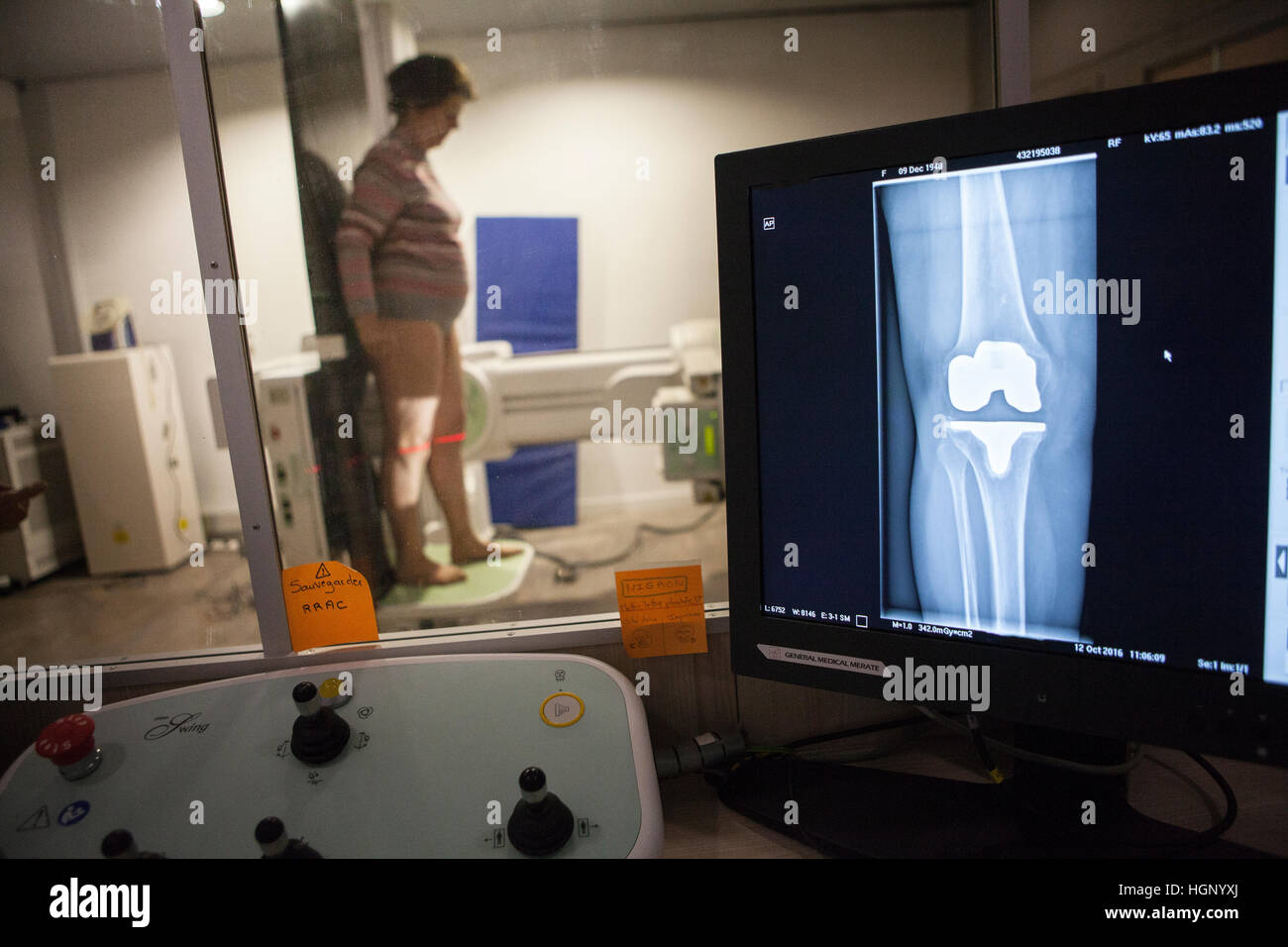 Older Female Patient Radiology High Resolution Stock Photography and ...