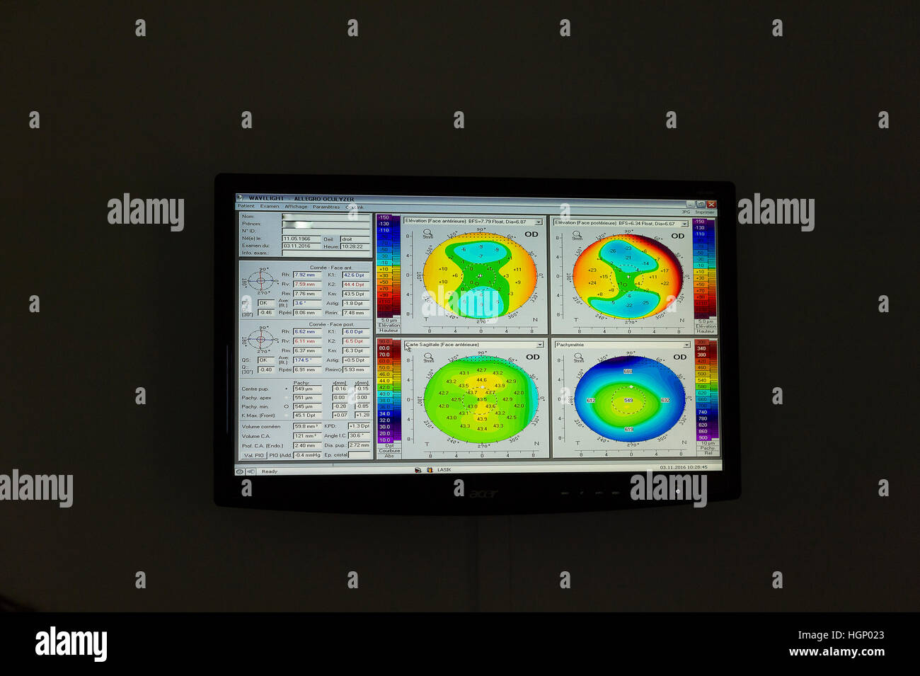 Corneal topography hi-res stock photography and images - Alamy