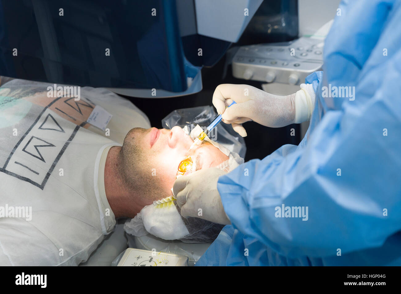 EYE LASER SURGERY Stock Photo - Alamy