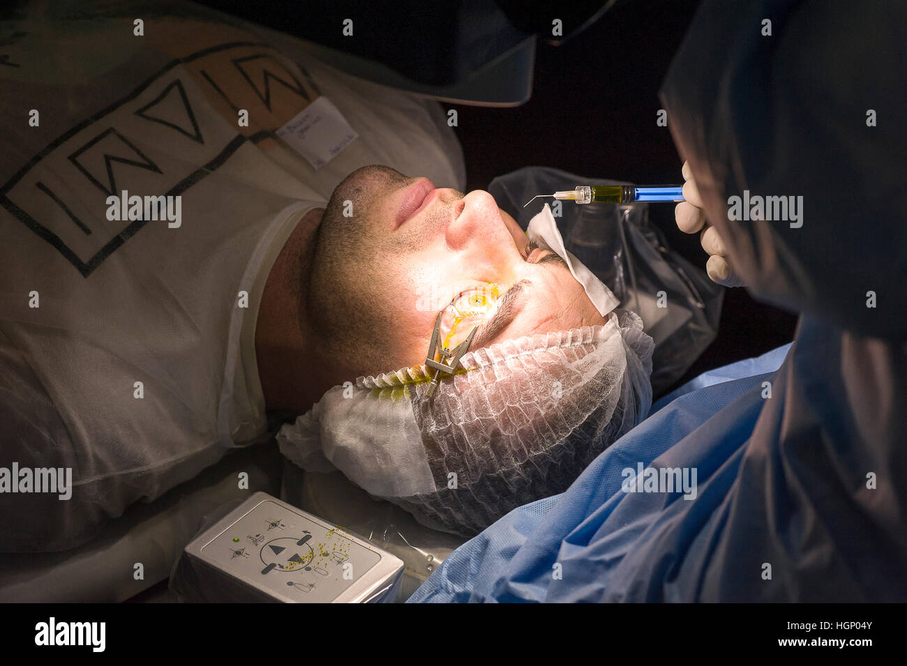 EYE LASER SURGERY Stock Photo - Alamy