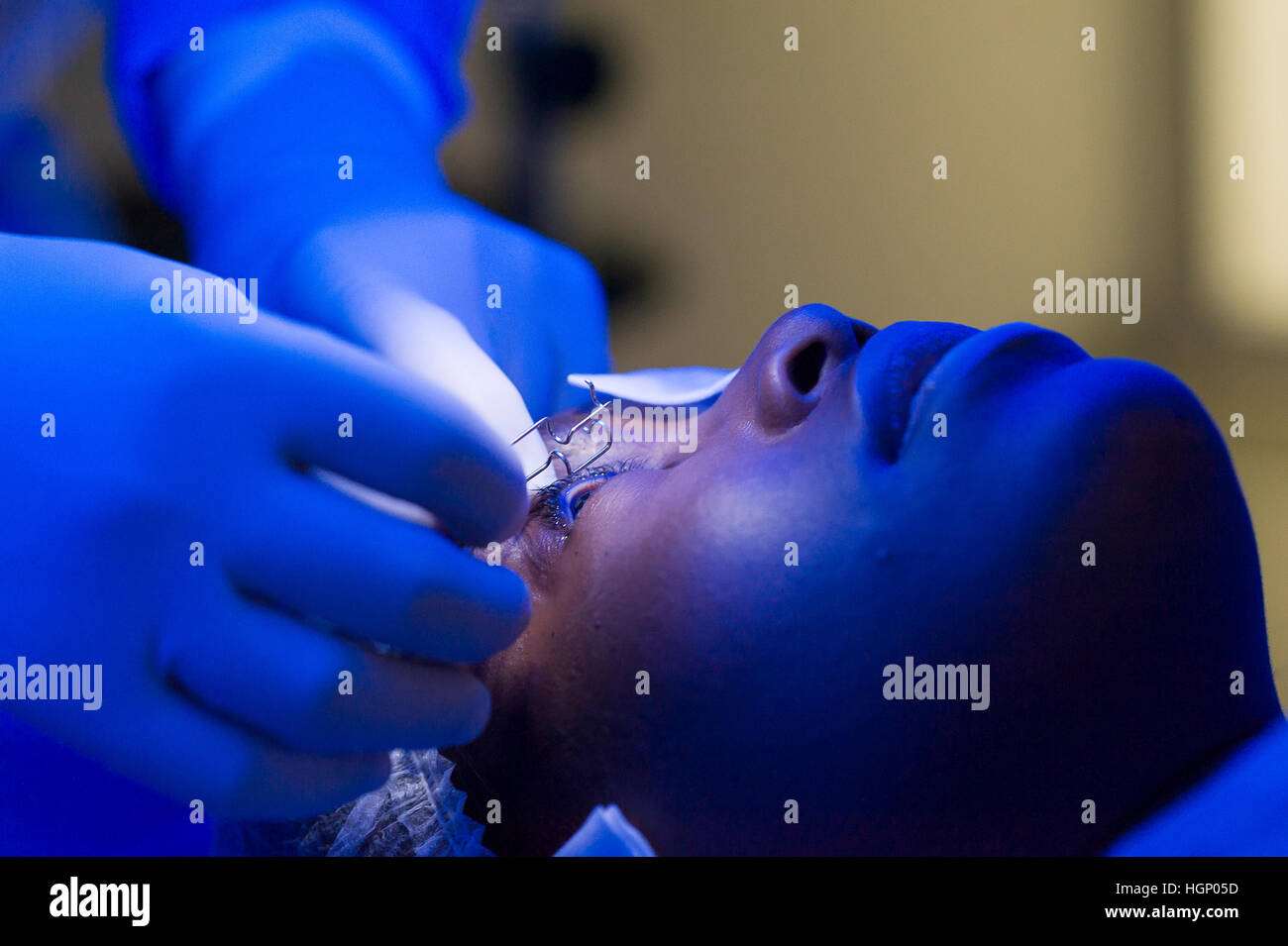 Ocular surgeries hi-res stock photography and images - Alamy