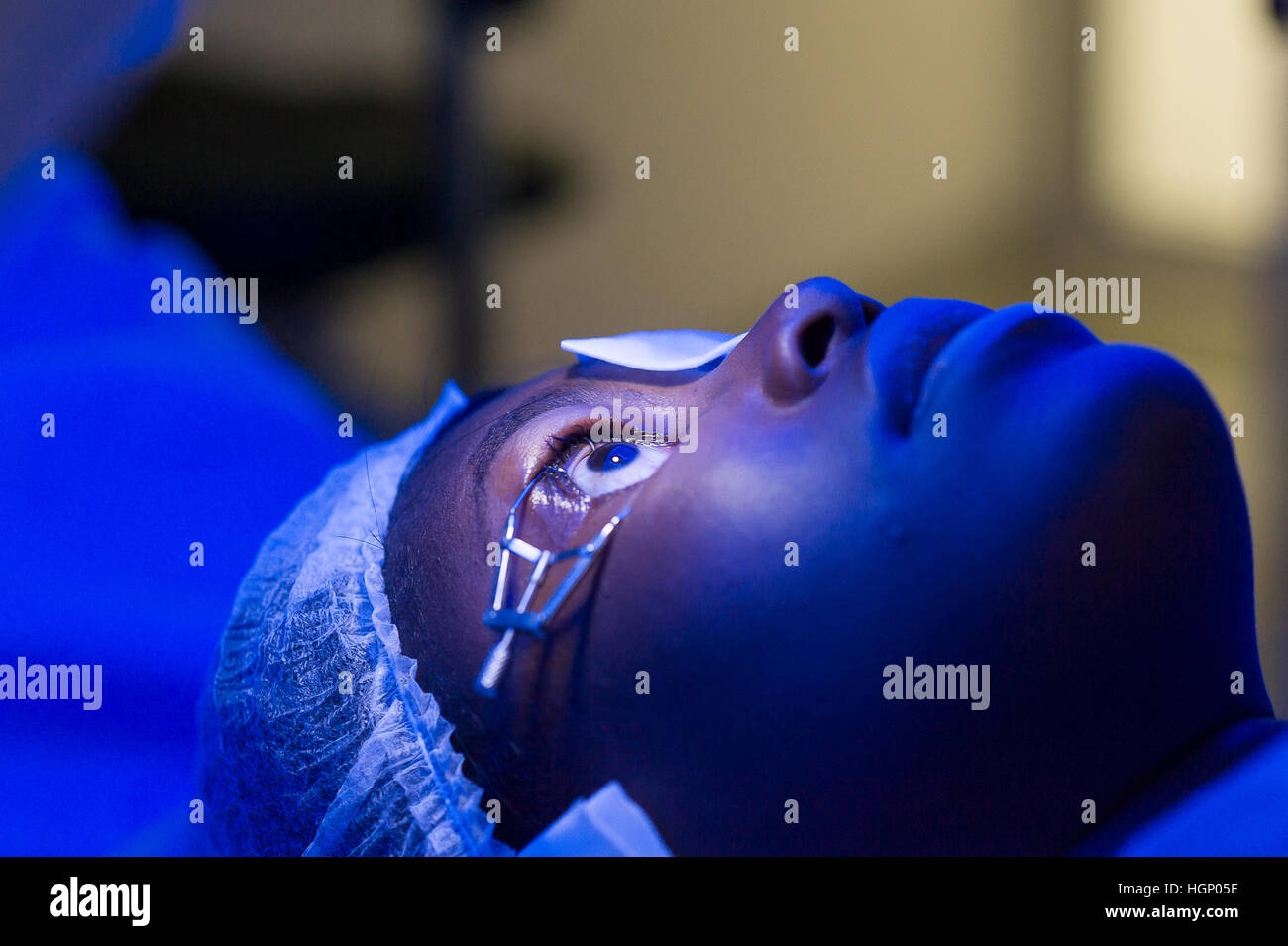 EYE LASER SURGERY Stock Photo - Alamy