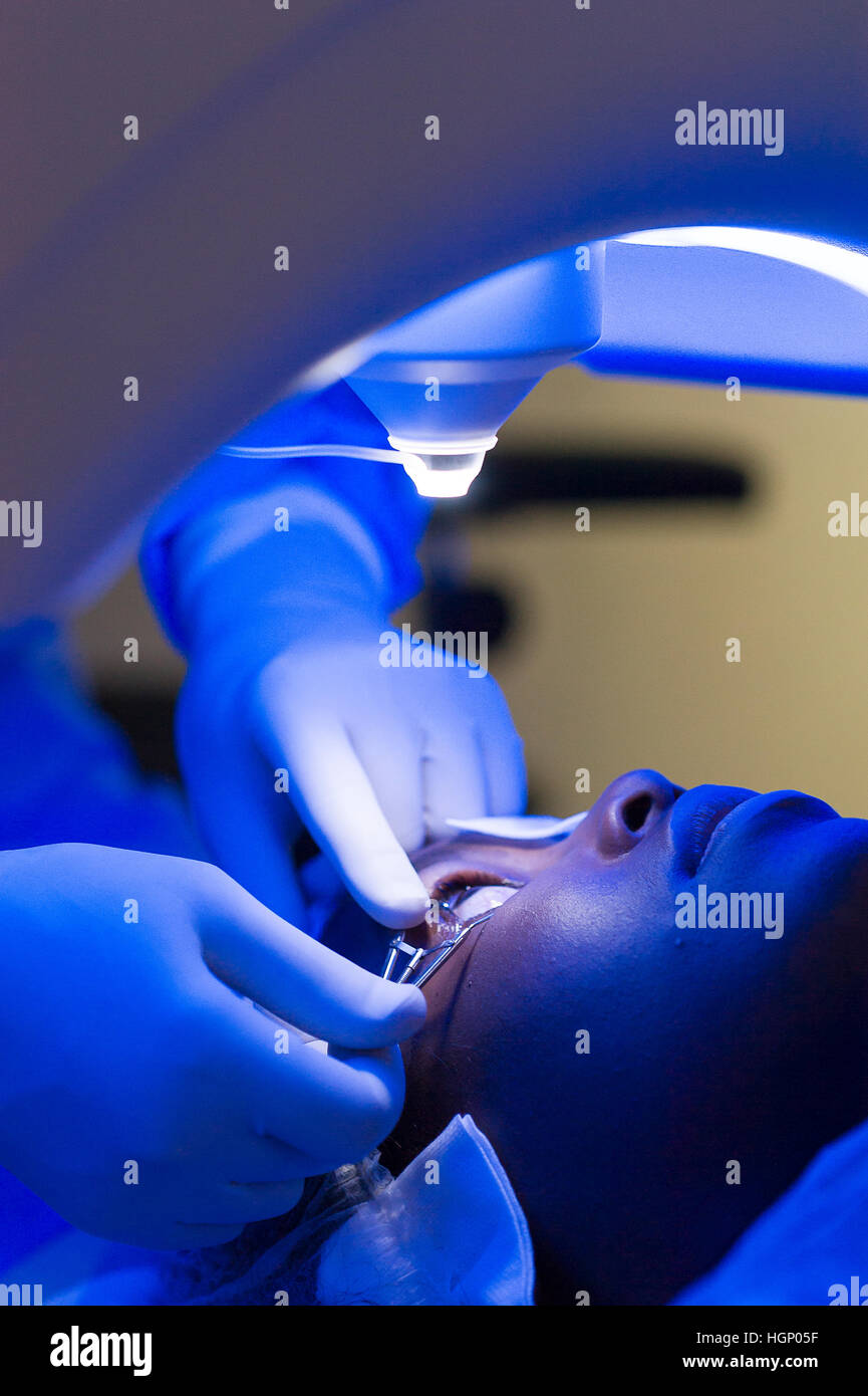 Eye retractor hi-res stock photography and images - Alamy