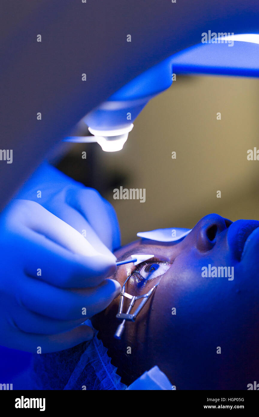 EYE LASER SURGERY Stock Photo - Alamy