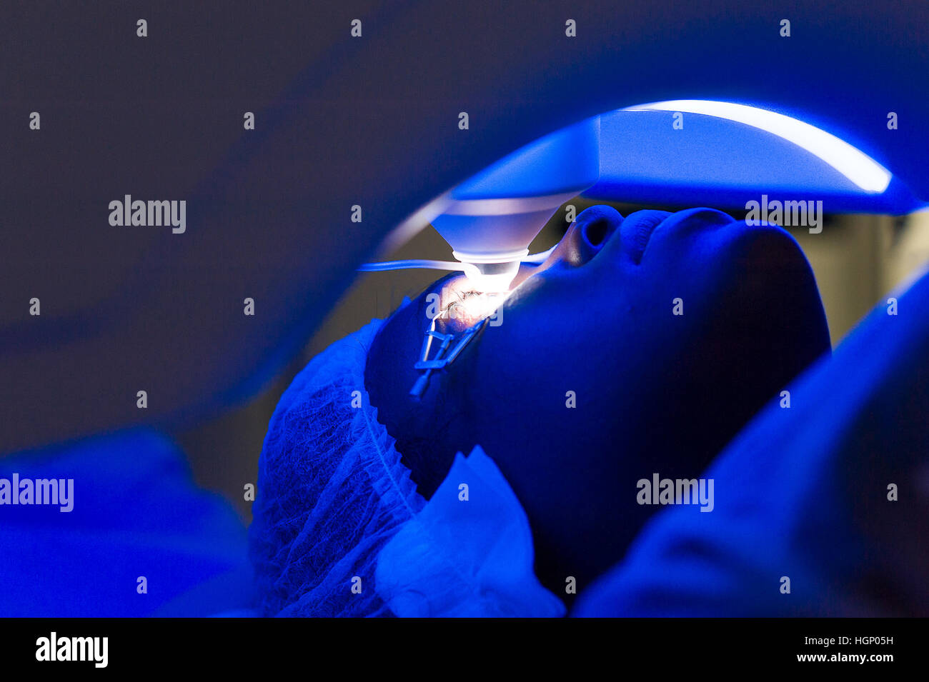 EYE LASER SURGERY Stock Photo - Alamy