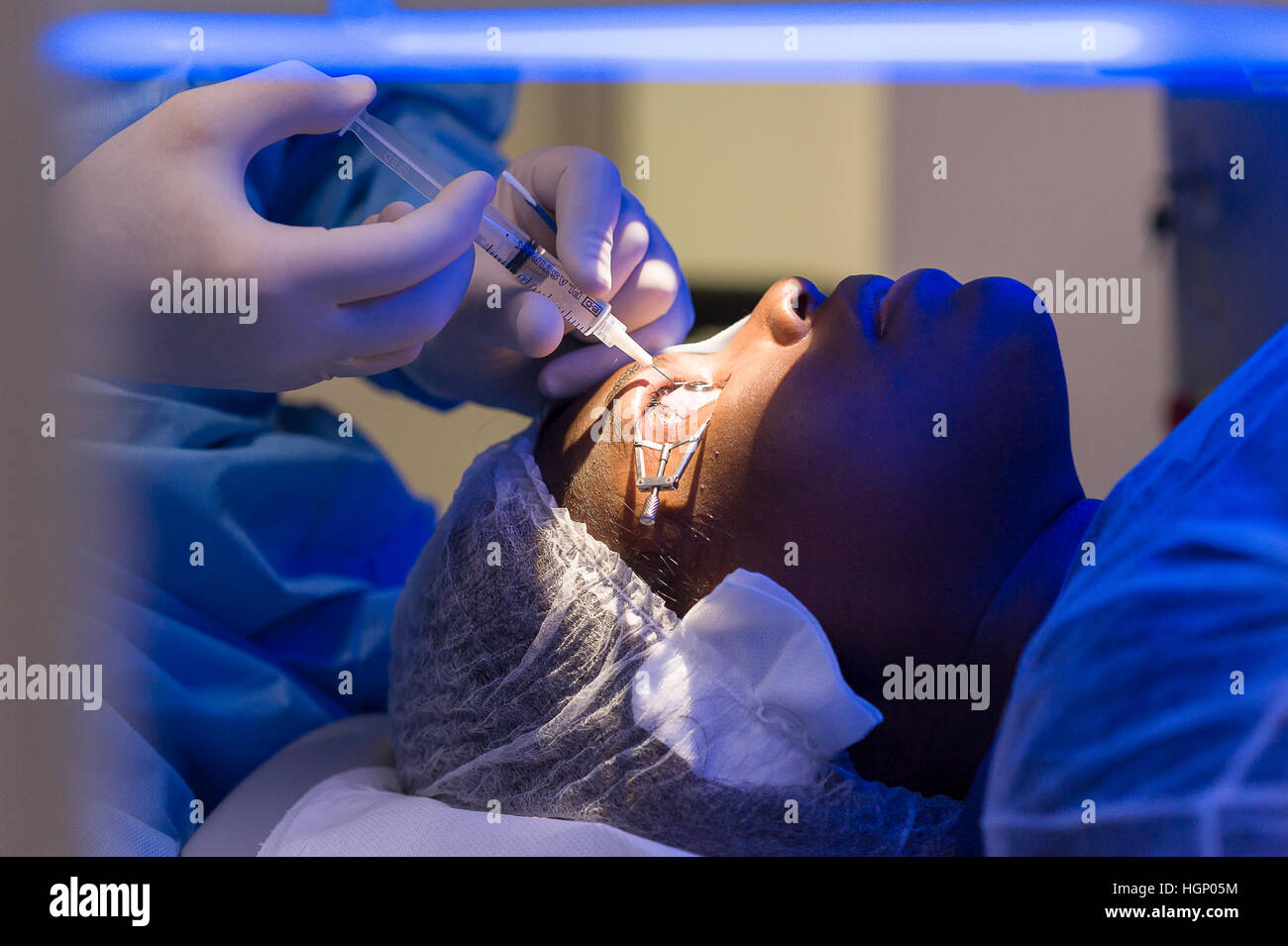 Eye surgery detail hi-res stock photography and images - Alamy