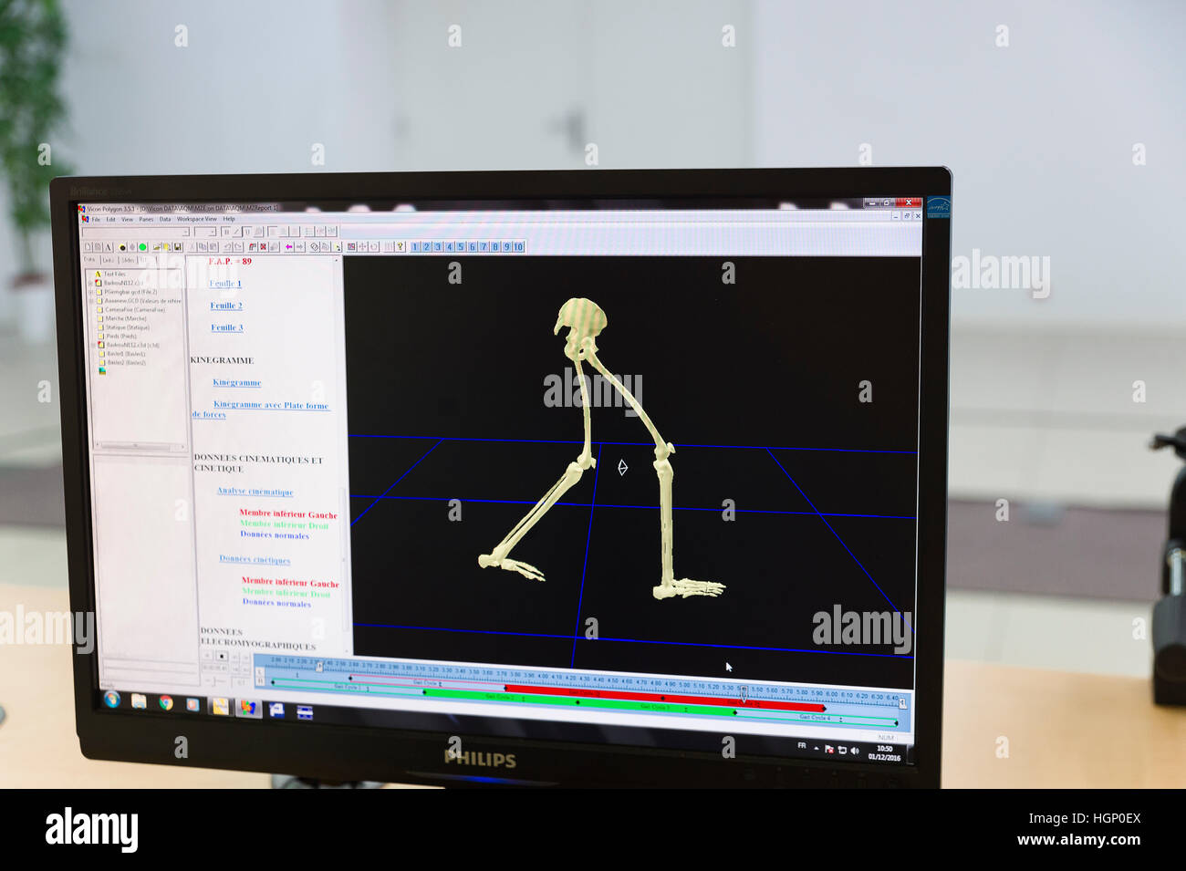 Physical rehabilitation centres hi-res stock photography and images - Alamy