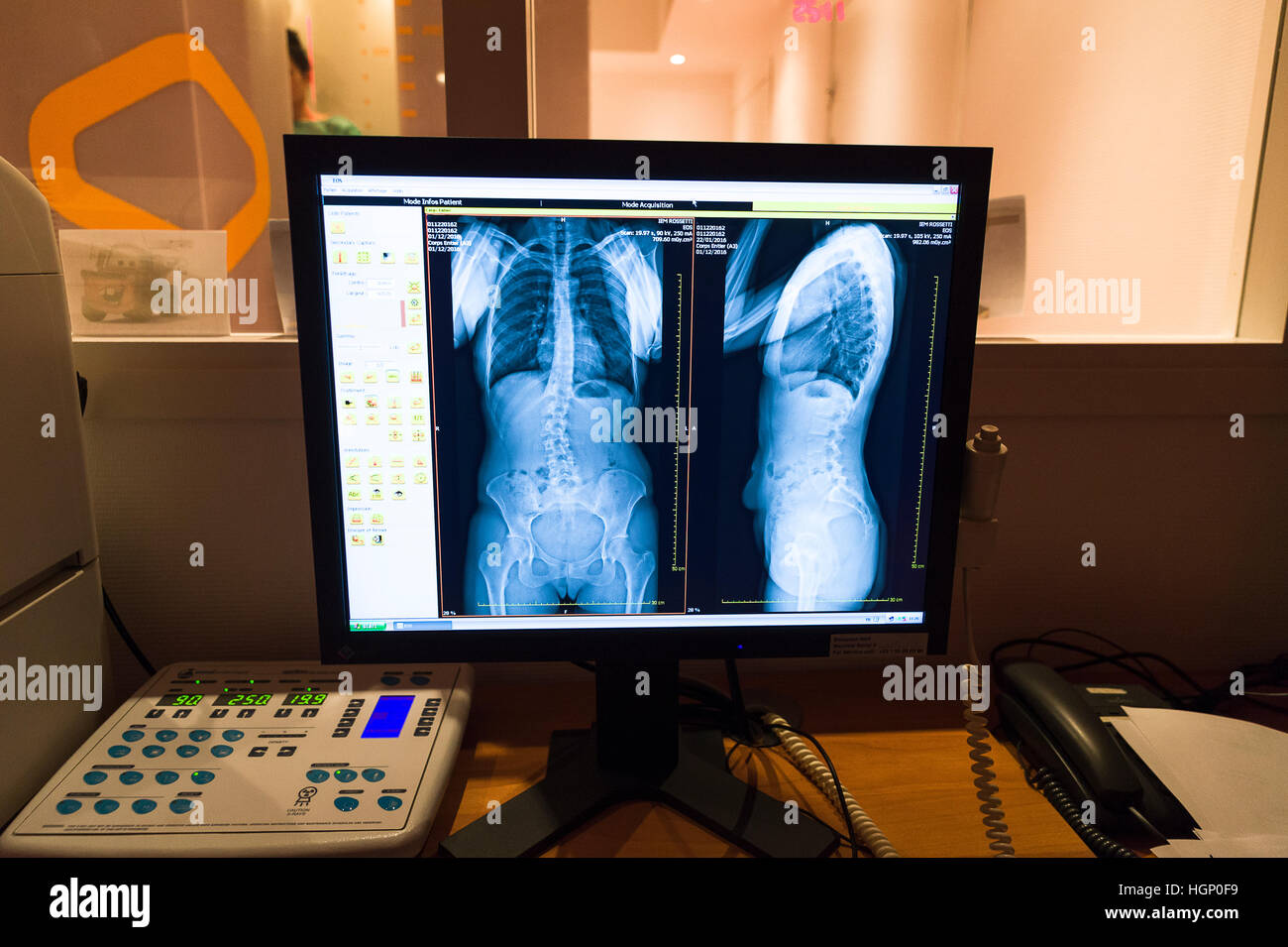 EOS X-RAY IMAGING Stock Photo - Alamy EOS X-RAY IMAGING Stock Photo - Alamy