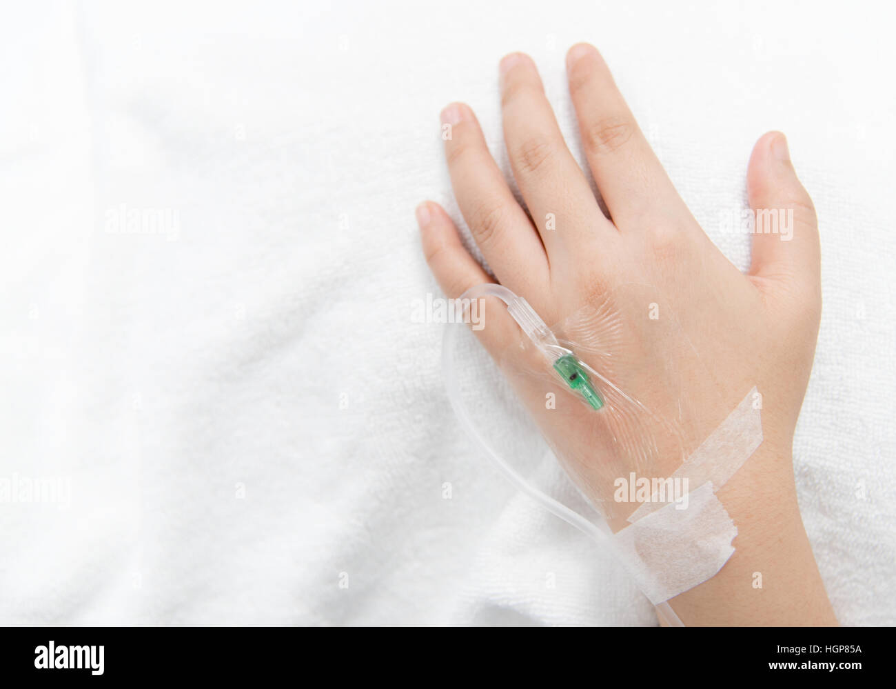 IV solution in a patients hand Stock Photo - Alamy