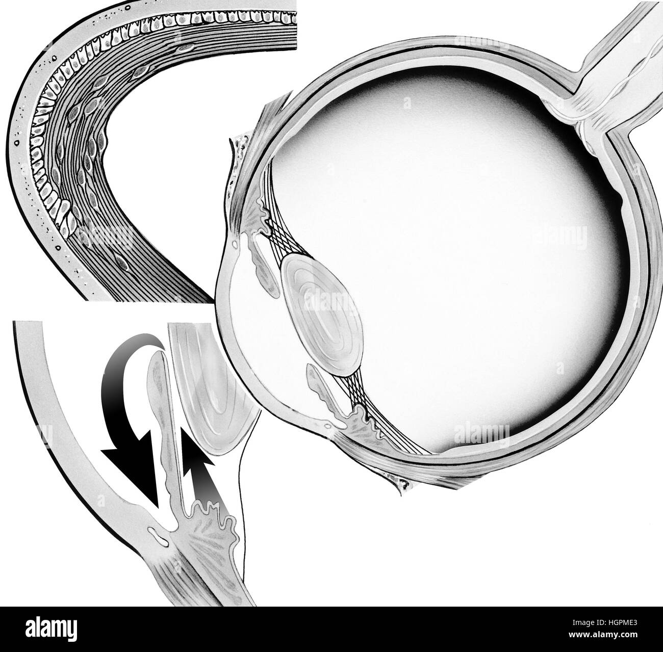 Cross section views of the human eye, showing normal anatomy (left ...