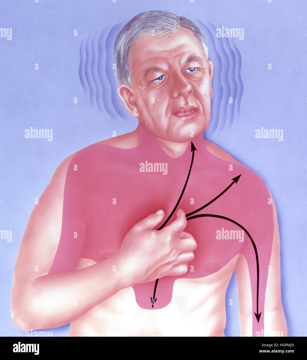 Man showing heart attack symptoms. Heart palitations, dizziness ...