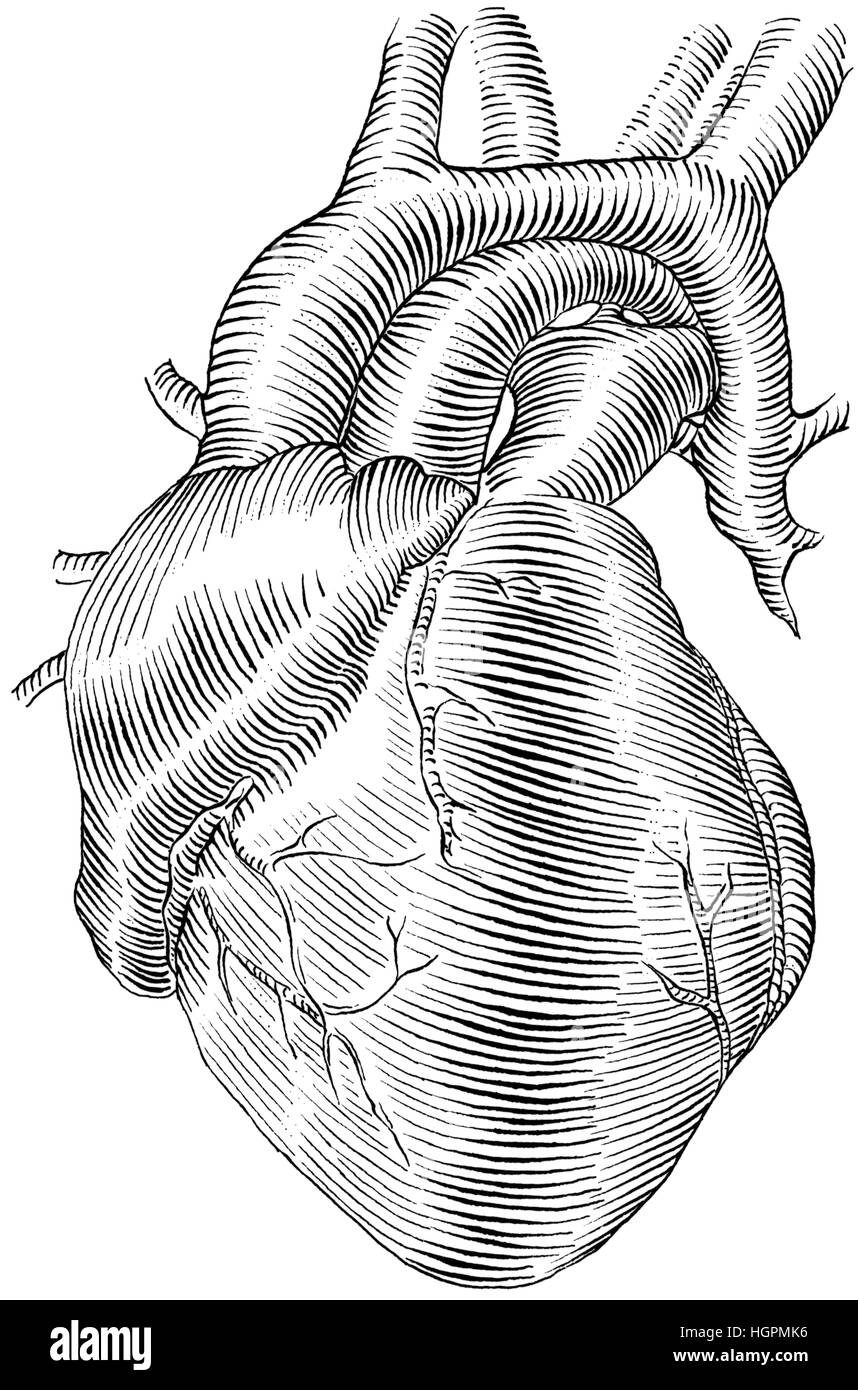 Enlarged heart muscle High Resolution Stock Photography and Images - Alamy