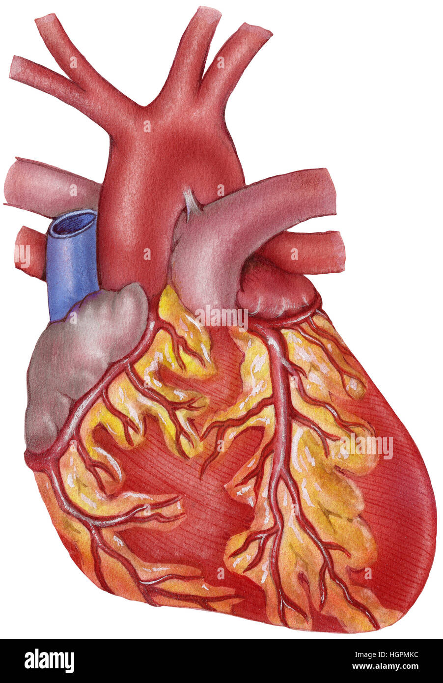 Enlarged heart muscle High Resolution Stock Photography and Images - Alamy
