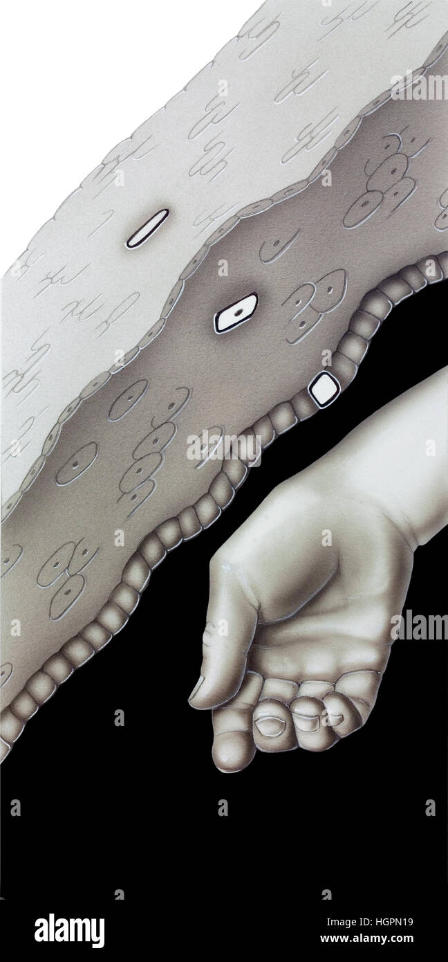 Skin- Dermal Layers. Shown are the upper epidermis, squameous cells ...