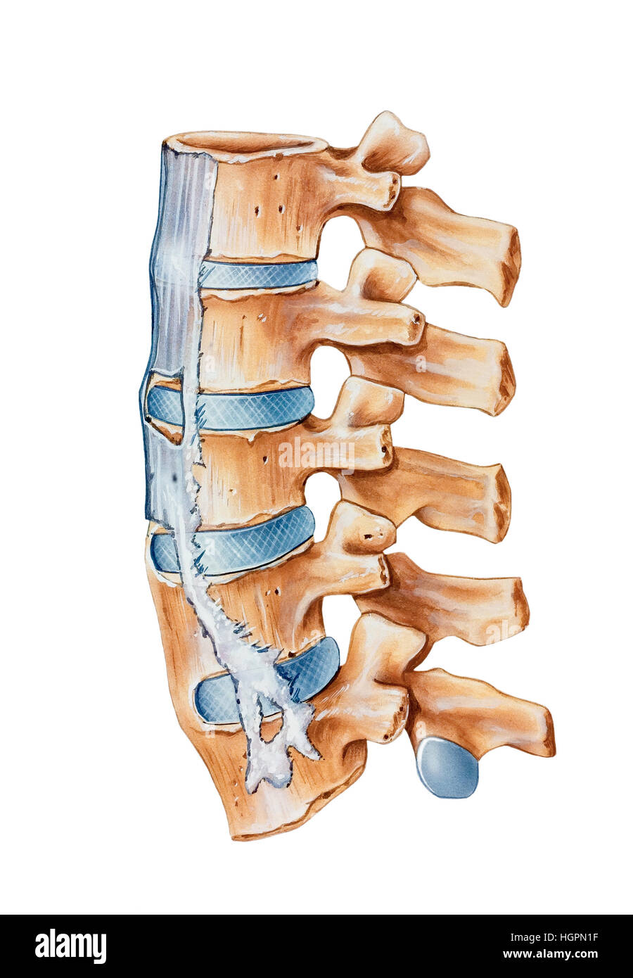 Spine - Ankylosing Spondylitis a condition with the symptoms of lower ...