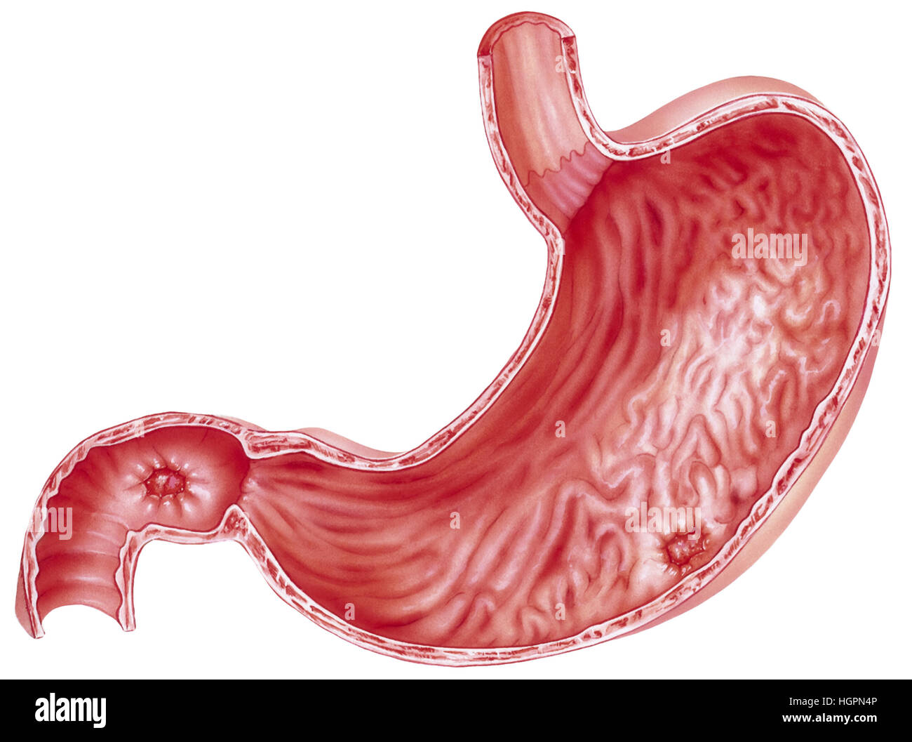 Pyloric sphincter hi-res stock photography and images - Alamy