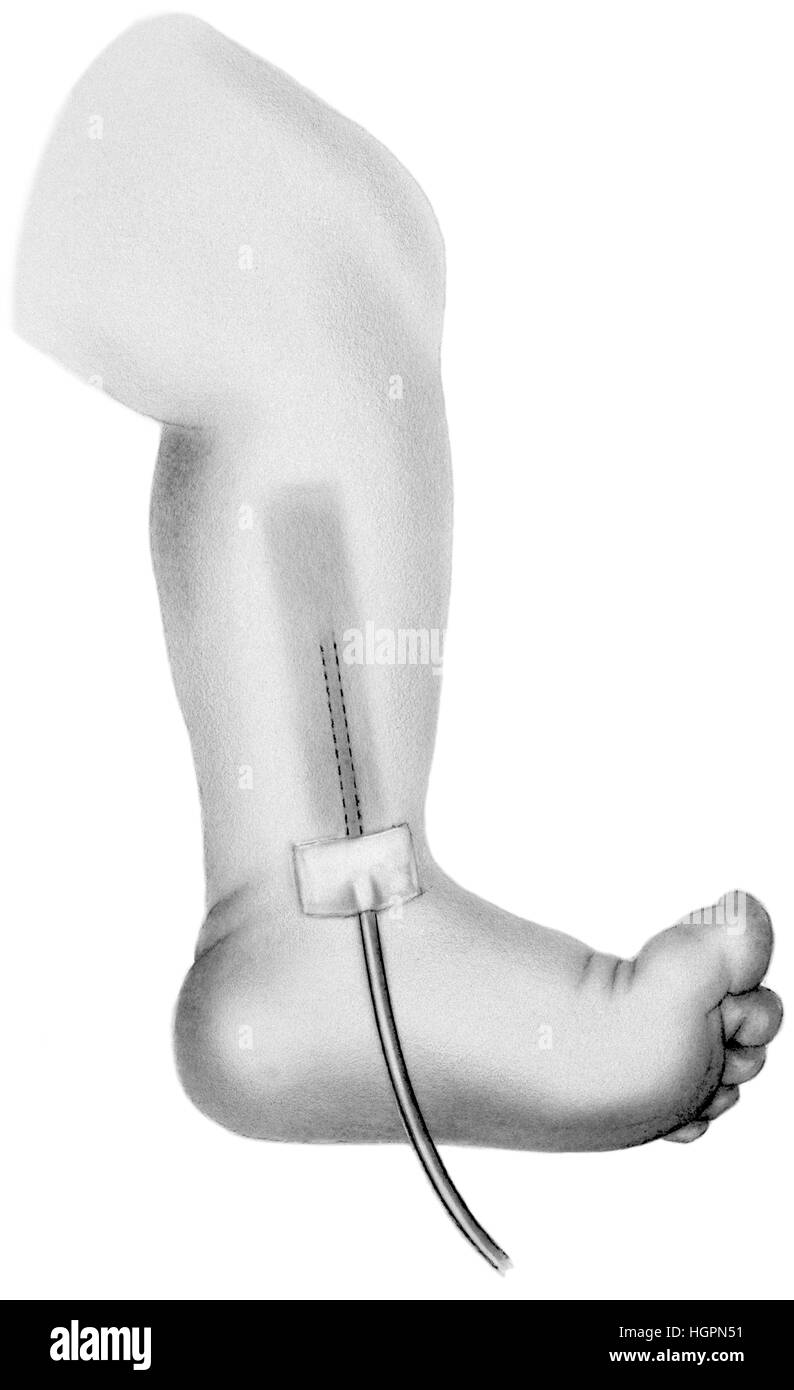 Penrose drain hi-res stock photography and images - Alamy