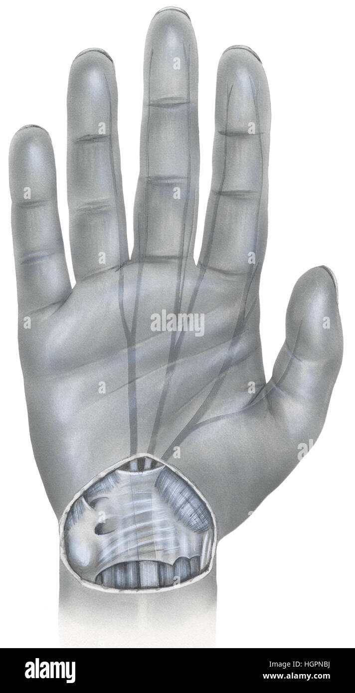 Tendon sheaths and carpal bones hi-res stock photography and images - Alamy