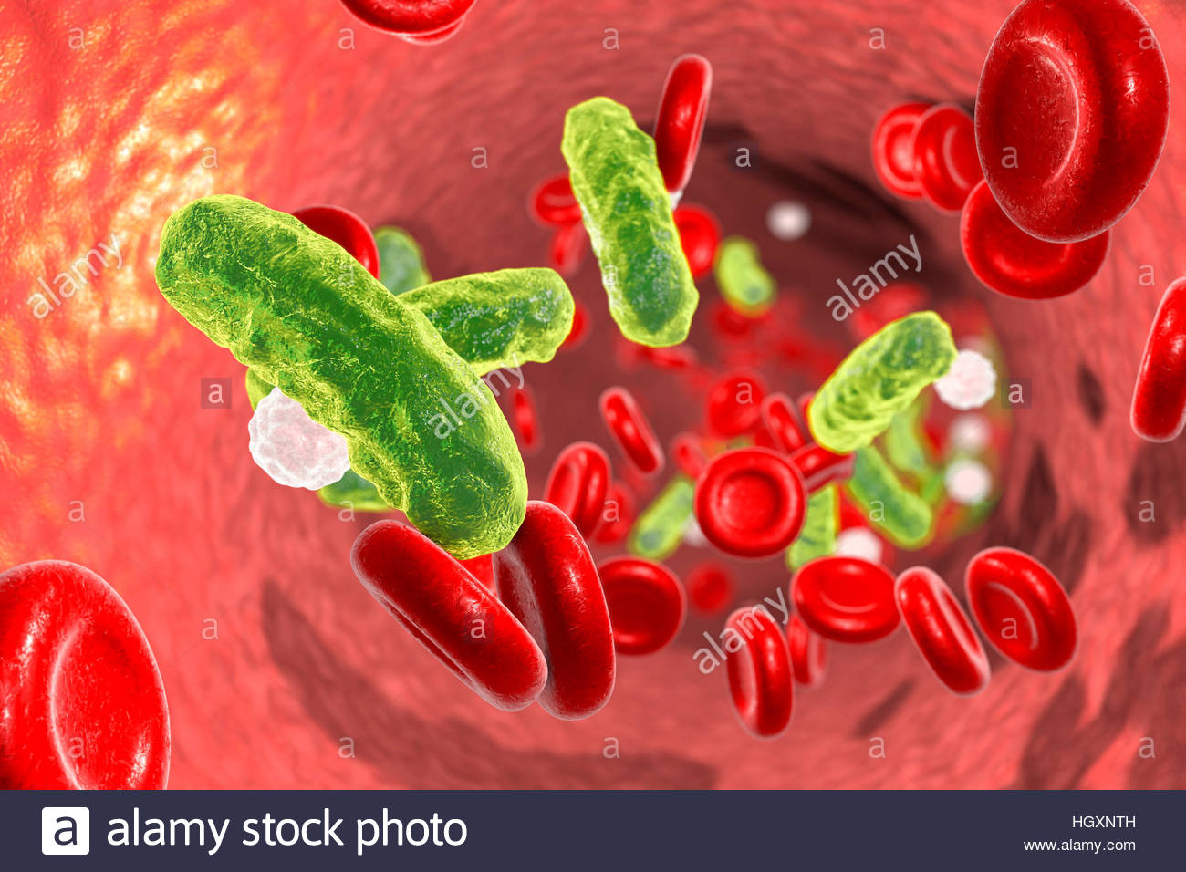 Bacterial Infection Artwork Stock Photos & Bacterial Infection Artwork ...