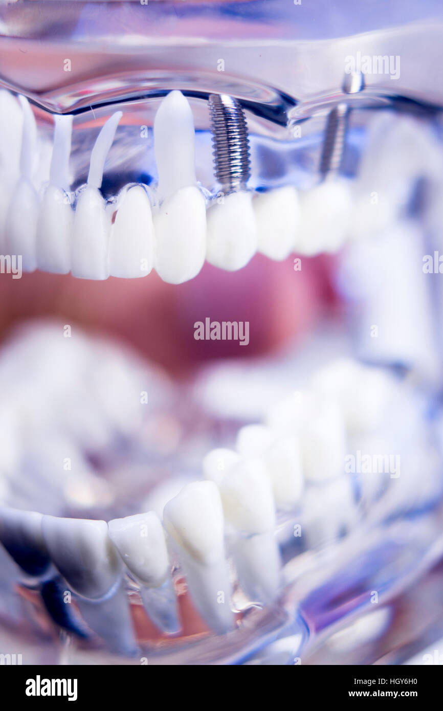 Dentists tooth plastic model used for teaching, learning and patient ...