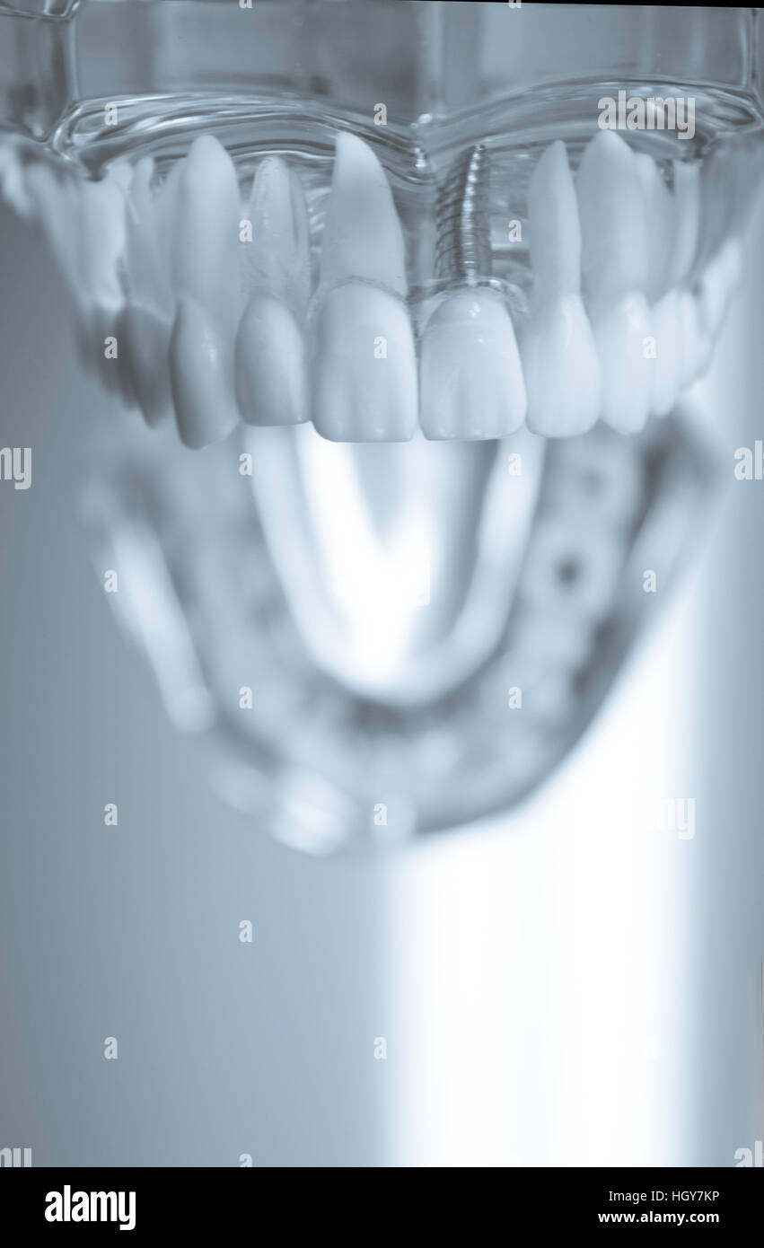 False teeth sample for dentists Stock Photo - Alamy