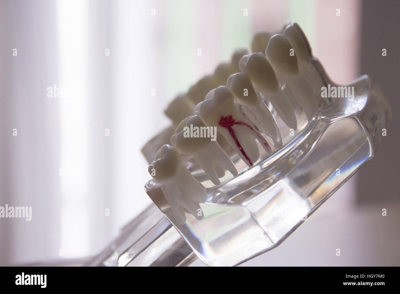 False teeth sample for dentists Stock Photo - Alamy