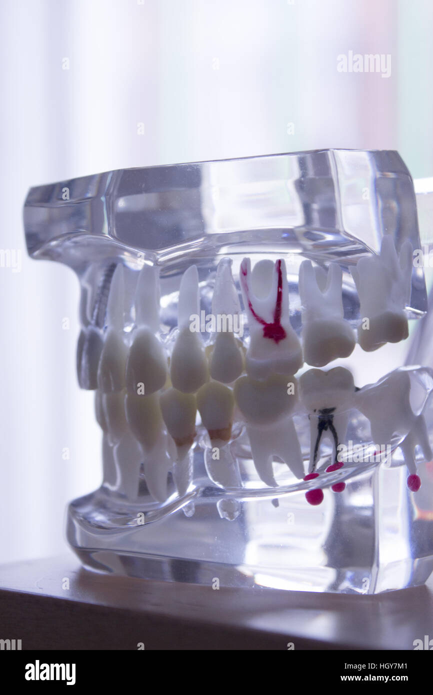 False teeth sample for dentists Stock Photo - Alamy