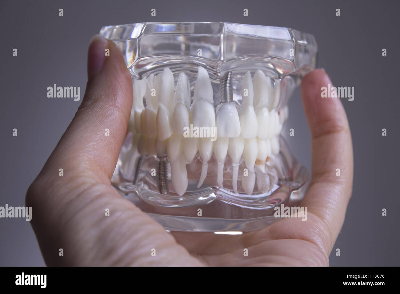 Woman holding false teeth hi-res stock photography and images - Alamy