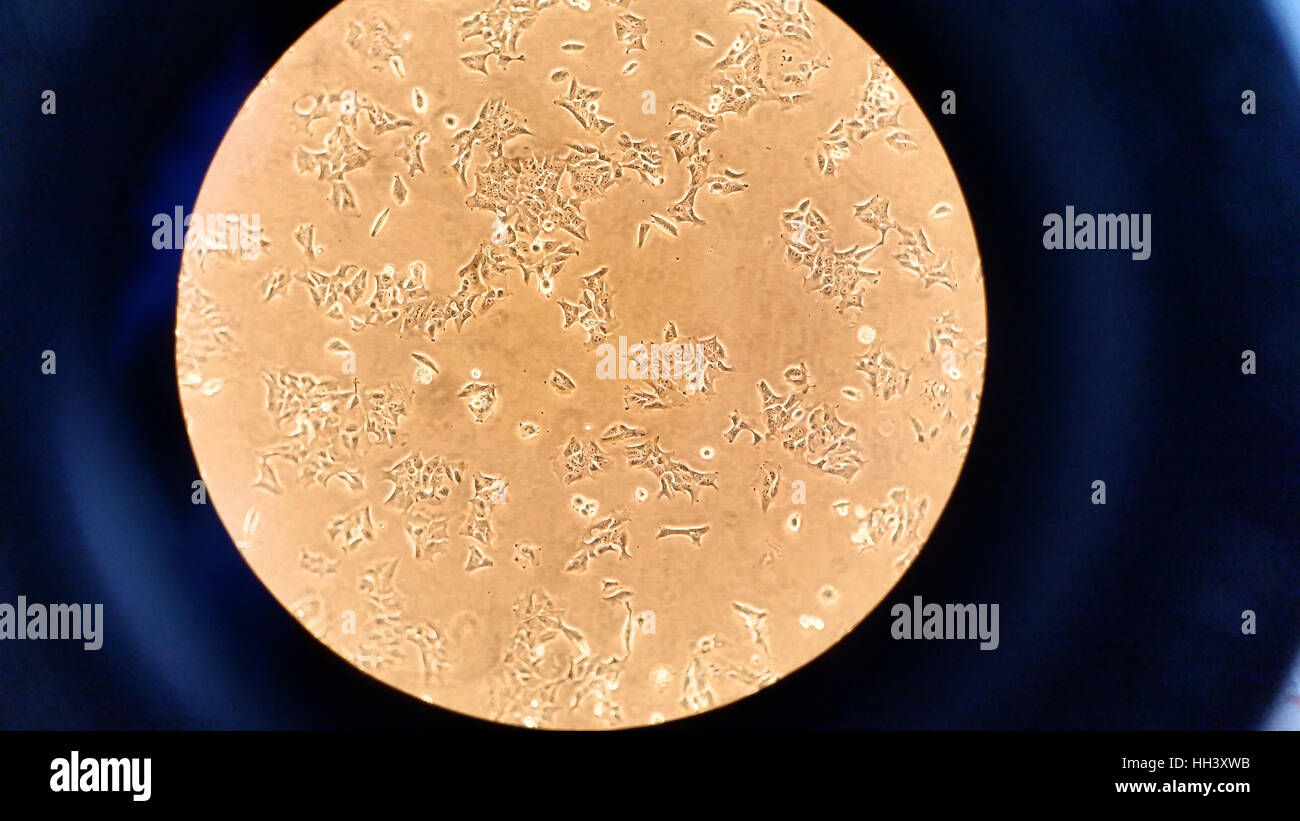 View through the microscope of a culture of a cancer cell line culture ...