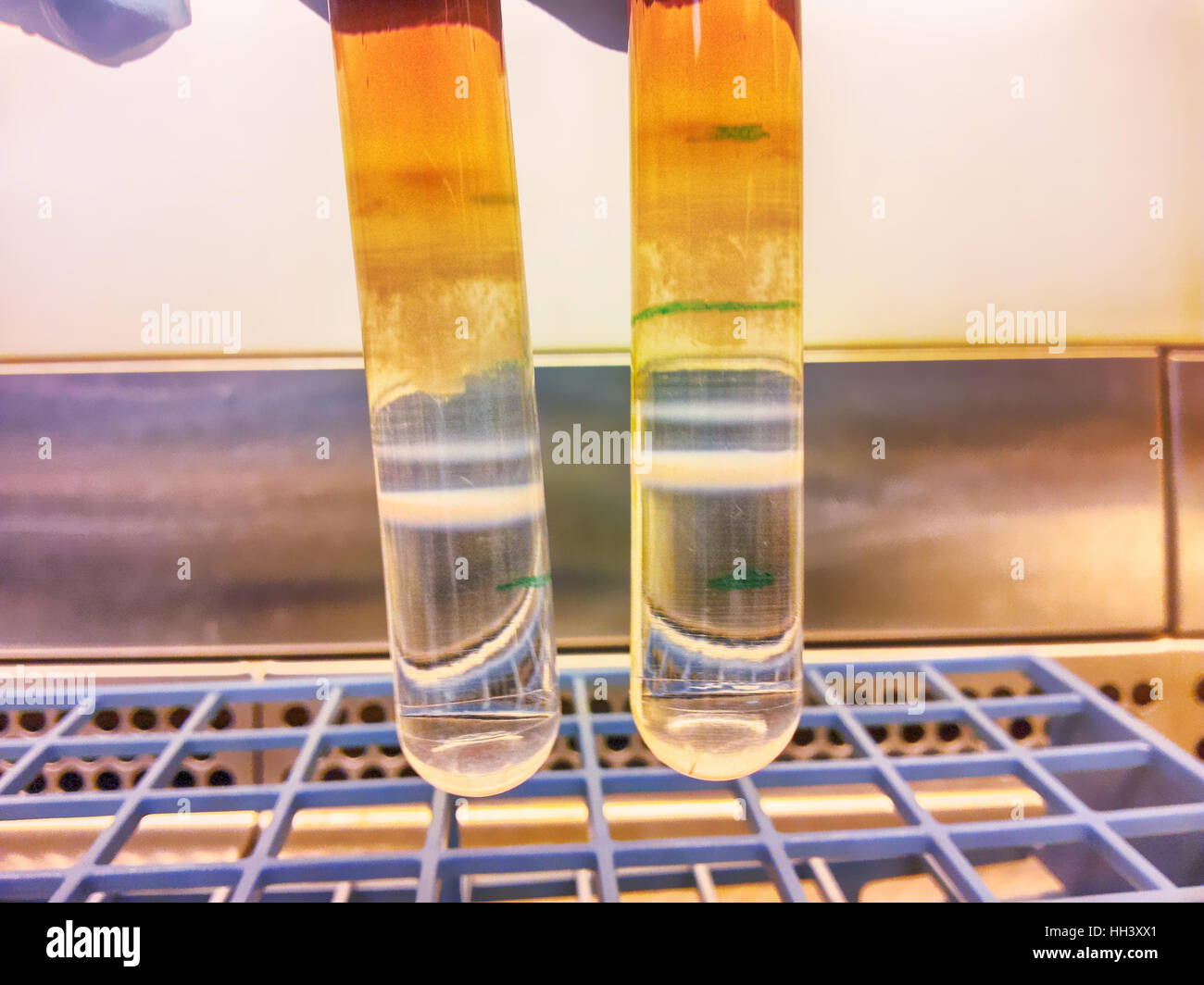 Oncolytic hi-res stock photography and images - Alamy