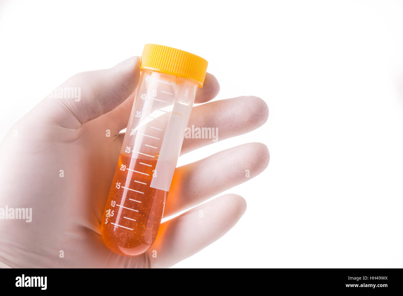 gloved hand keeps the filled sample tube, the vial is filled with a ...