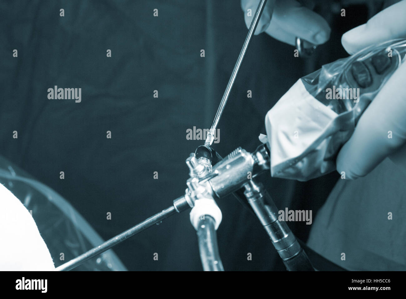 Surgical operation for knee arthroscopy micro surgery in hospital ...